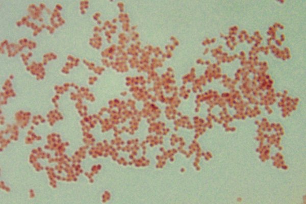 Aeromonas salmonicida subsp. salmonicida